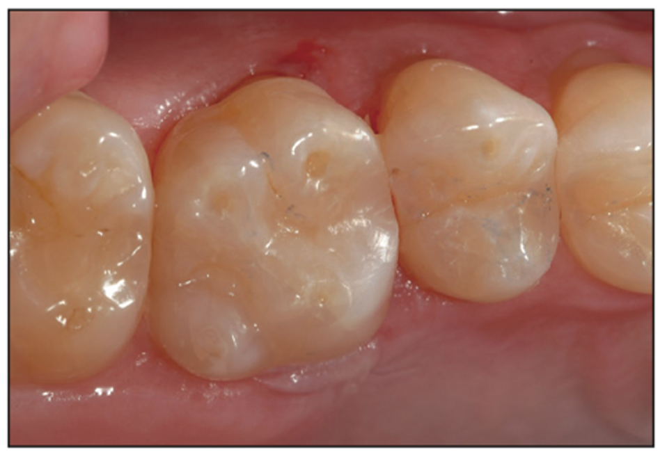 Modern Technology for Minimally Invasive Dentistry – Dentistry Today