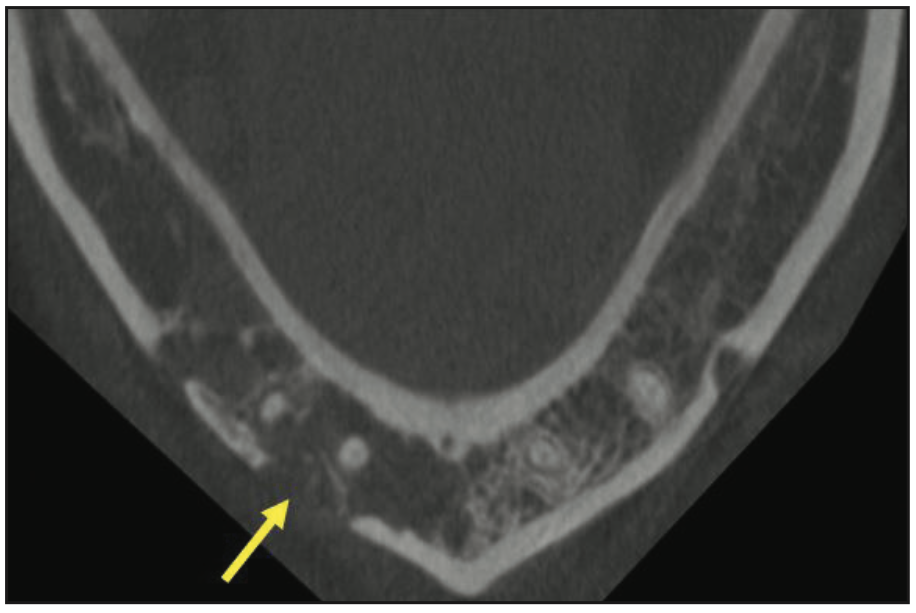 CBCT in the Age of Digital Dentistry: A Great Asset or a Great ...
